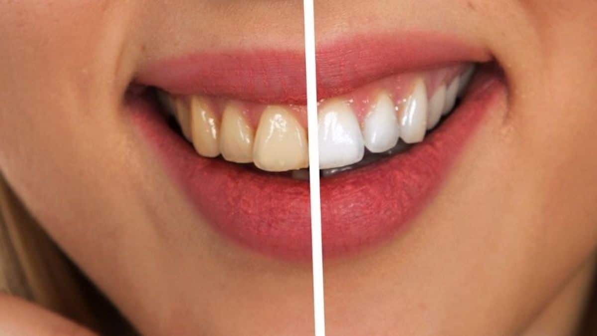 4 astuces faciles et magiques pour blanchir les dents en 5 minutes sans ... 4 astuces faciles et magiques pour blanchir les dents en 5 minutes sans ...
